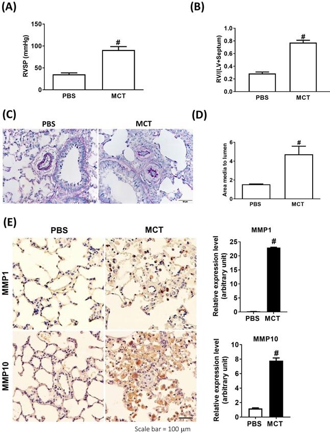 MMP-10 from M1 macrophages promotes pulmonary vascular remodeling and ...