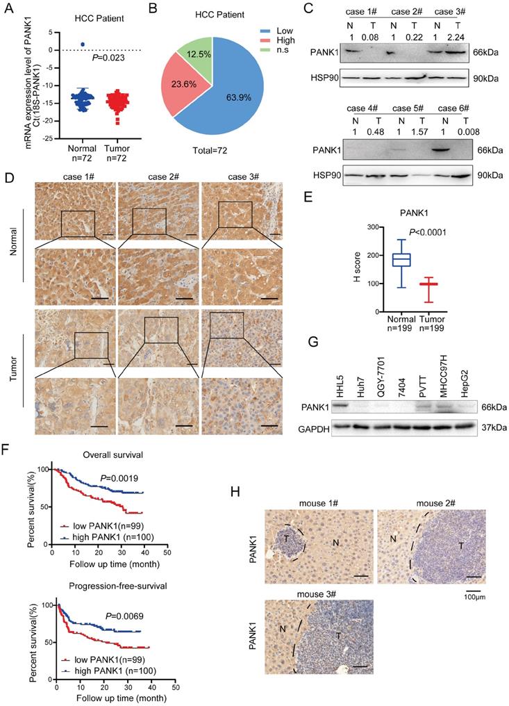 Pantothenate Kinase 1 Inhibits the Progression of Hepatocellular ...