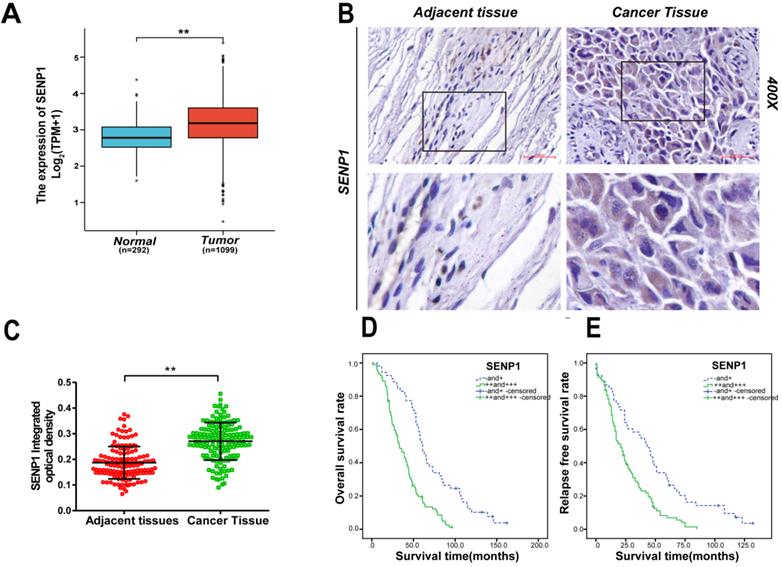 SENP1 promotes triple-negative breast cancer invasion and metastasis ...