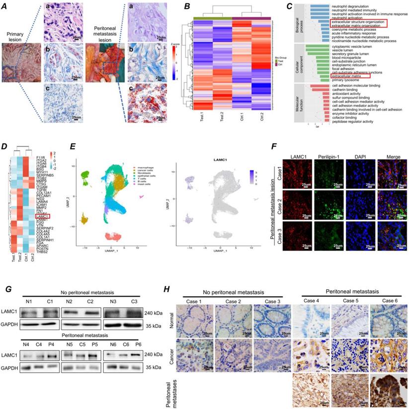LAMC1-mediated preadipocytes differentiation promoted peritoneum pre ...