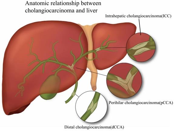 Tumor Microenvironment and its Implications for Antitumor Immunity in ...