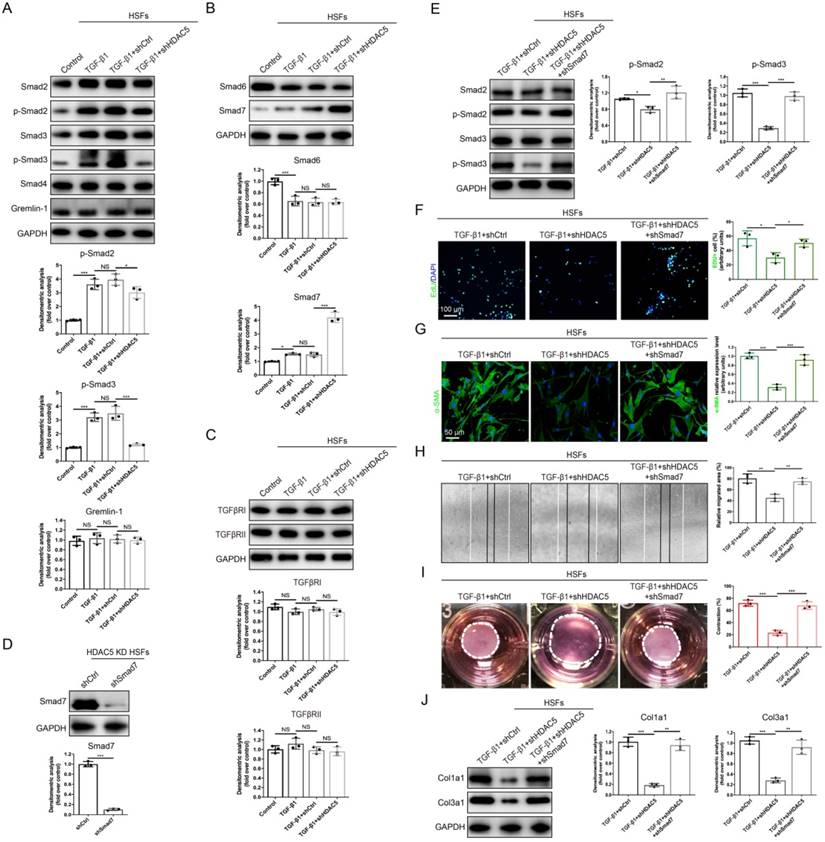HDAC5-mediated Smad7 silencing through MEF2A is critical for fibroblast ...