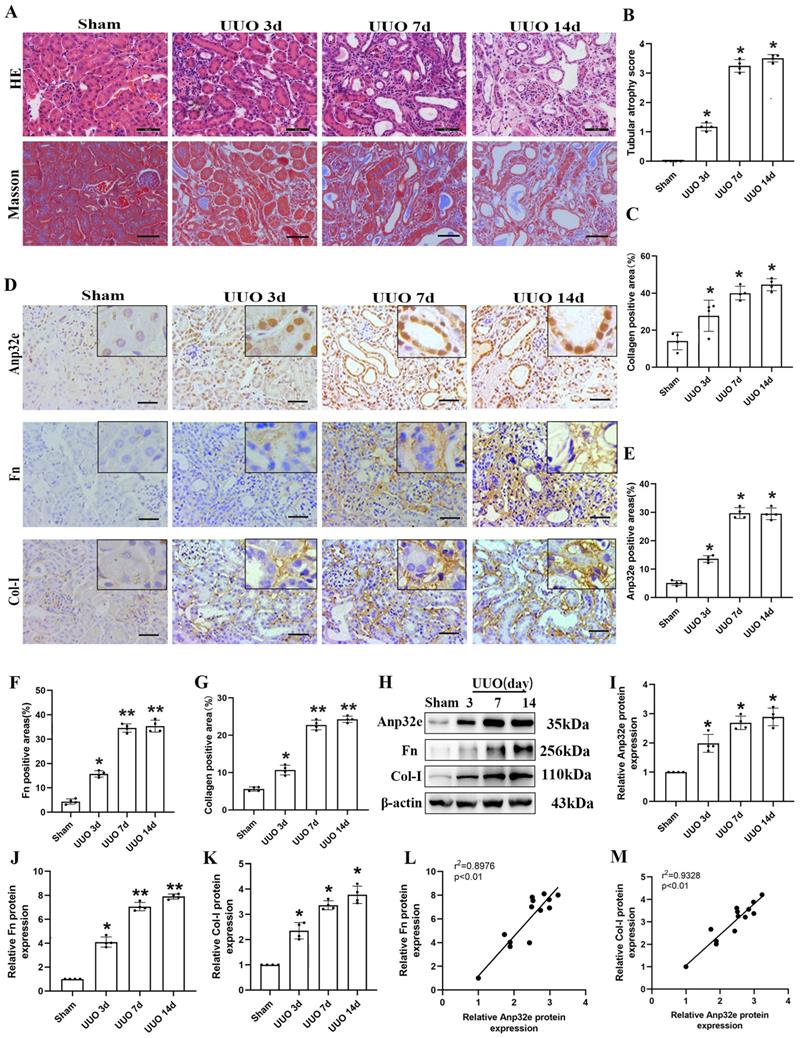 Anp32e promotes renal interstitial fibrosis by upregulating the ...