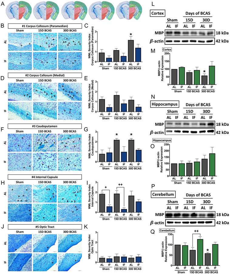 Intermittent Fasting Attenuates Hallmark Vascular and Neuronal ...