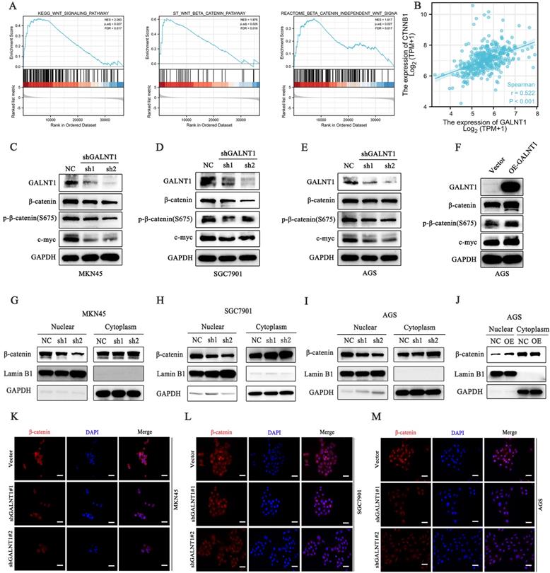 GALNT1 Enhances Malignant Phenotype of Gastric Cancer via Modulating ...