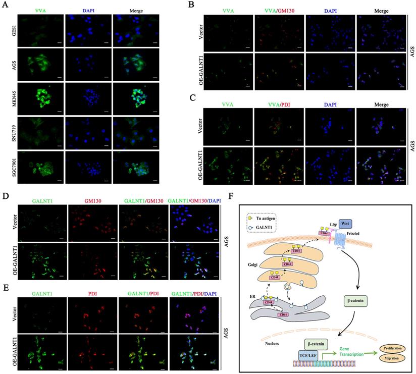 GALNT1 Enhances Malignant Phenotype of Gastric Cancer via Modulating ...