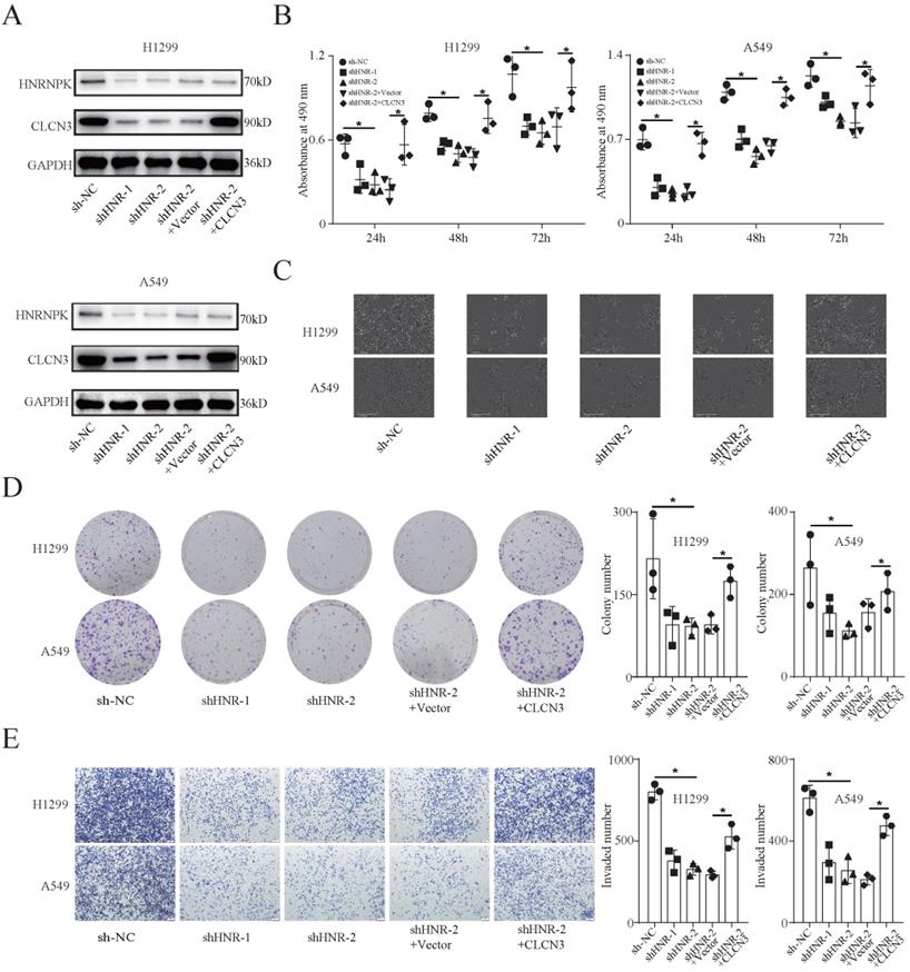 HNRNPK/CLCN3 axis facilitates the progression of LUAD through CAF-tumor ...