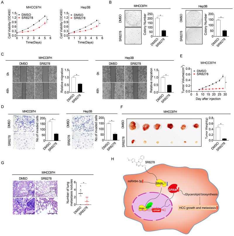 Down-regulation of BMAL1 by MiR-494-3p Promotes Hepatocellular ...