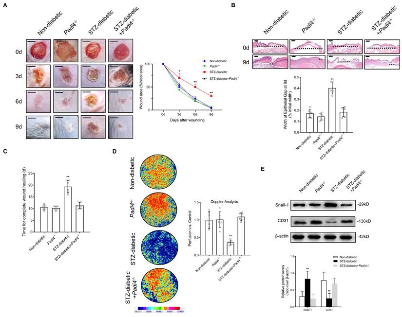 Neutrophil Extracellular Traps Delay Diabetic Wound Healing by Inducing ...