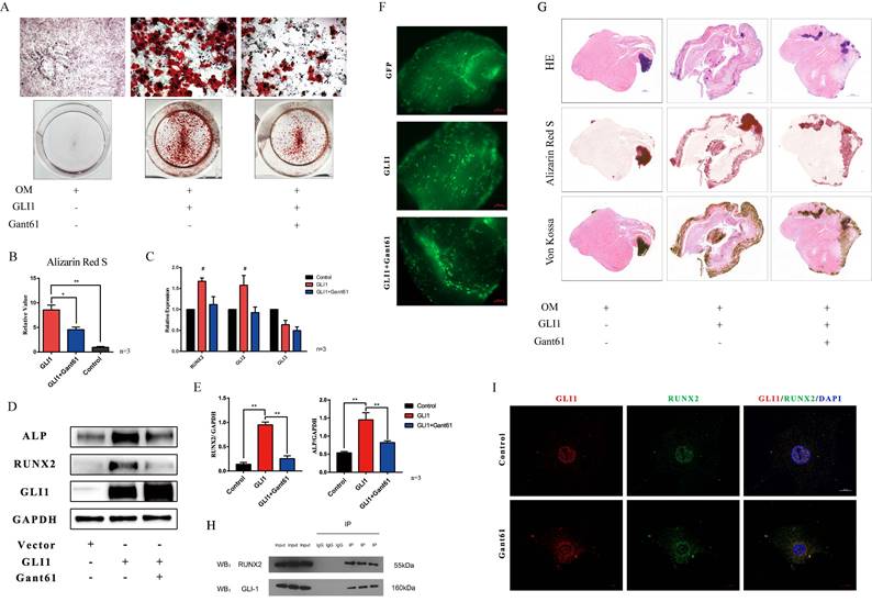 Gli1 promotes the phenotypic transformation of valve interstitial cells ...