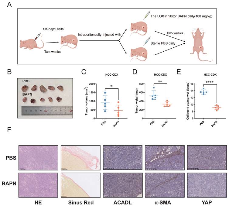 Bulk and single-cell transcriptome profiling reveal extracellular ...
