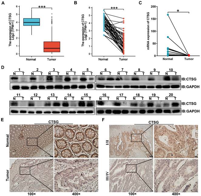 CTSG Suppresses Colorectal Cancer Progression through Negative ...