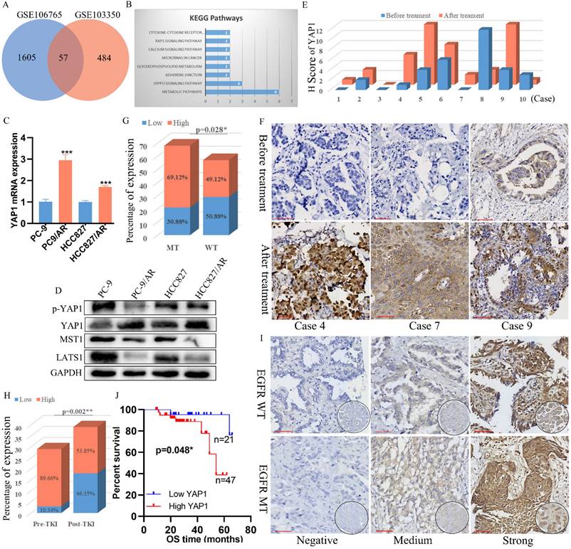 YAP1 synergize with YY1 transcriptional co-repress DUSP1 to induce ...