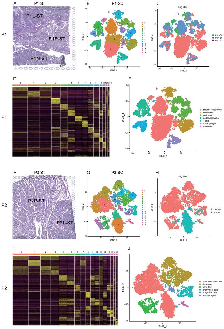 Integrating Spatial Transcriptomics and Single-nucleus RNA Sequencing ...