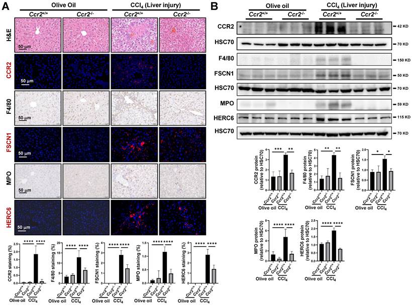 C-C motif chemokine receptor 2 inhibition reduces liver fibrosis by ...
