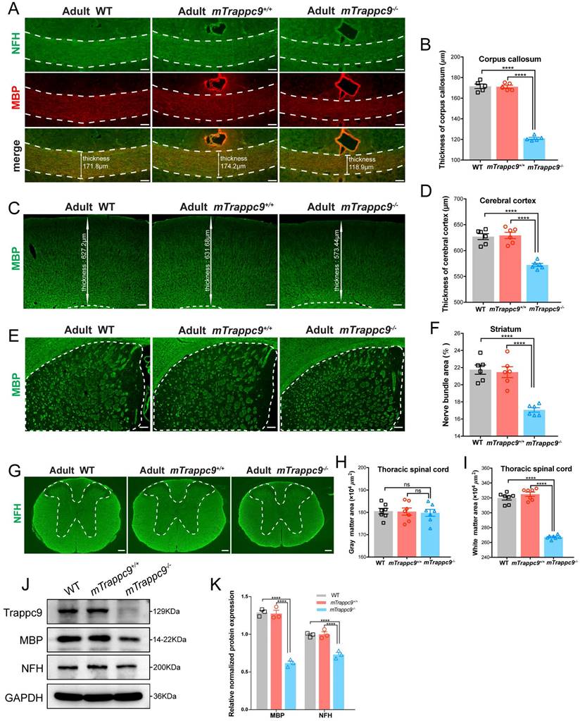 Defective neurite elongation and branching in Nibp/Trappc9 deficient ...