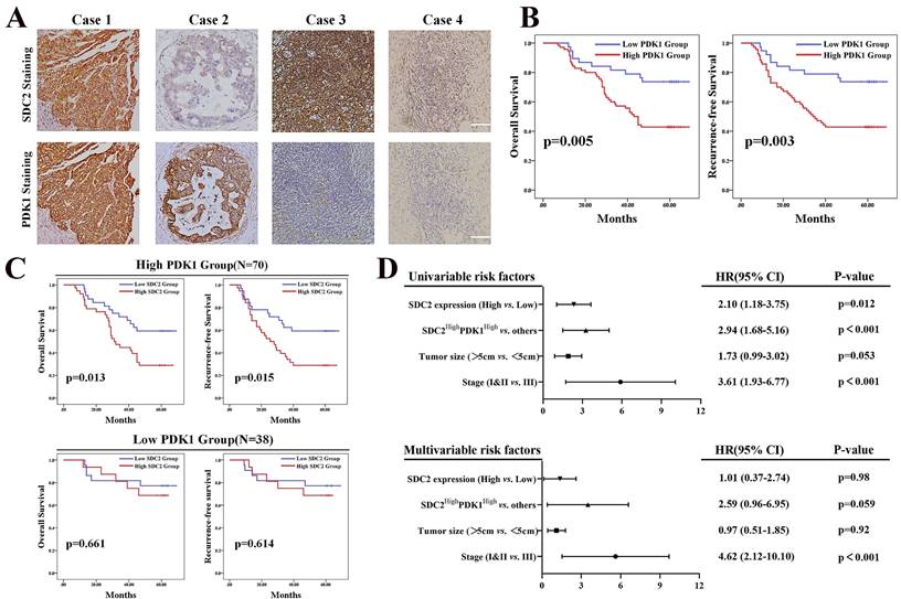 SDC2 Stabilization by USP14 Promotes Gastric Cancer Progression through ...