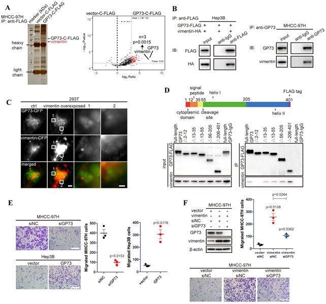 Golgi-protein 73 facilitates vimentin polymerization in hepatocellular ...