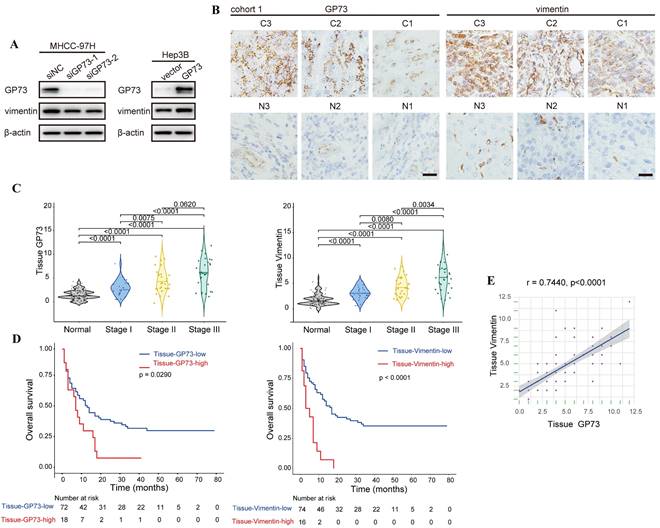 Golgi-protein 73 facilitates vimentin polymerization in hepatocellular ...