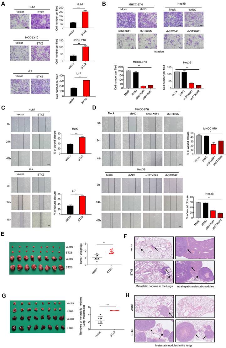 Syntaxin-6 promotes the progression of hepatocellular carcinoma and ...