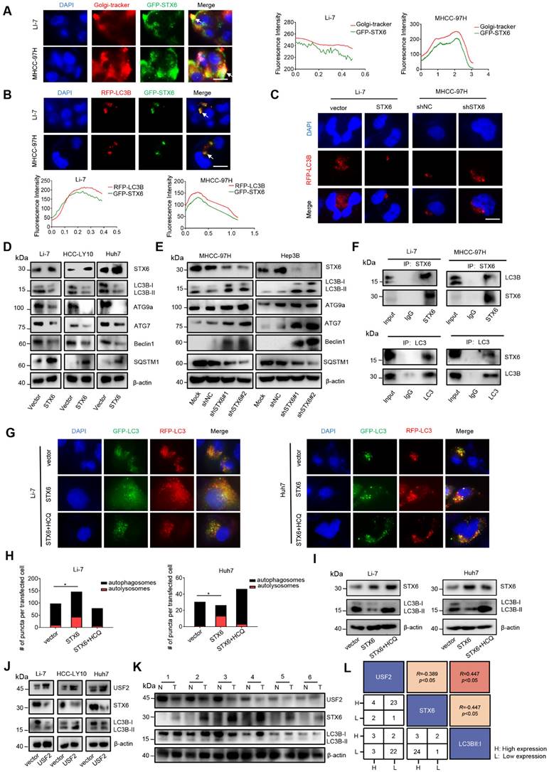 Syntaxin-6 promotes the progression of hepatocellular carcinoma and ...
