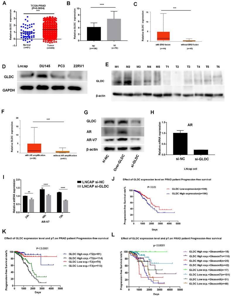 Glycine Decarboxylase (GLDC) Plays a Crucial Role in Regulating Energy ...