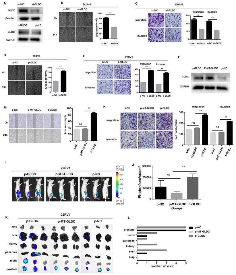 Glycine Decarboxylase (GLDC) Plays a Crucial Role in Regulating Energy ...