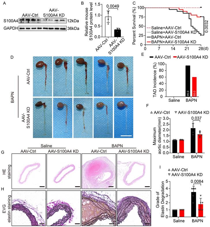 S100A4 Is a Key Facilitator of Thoracic Aortic Dissection