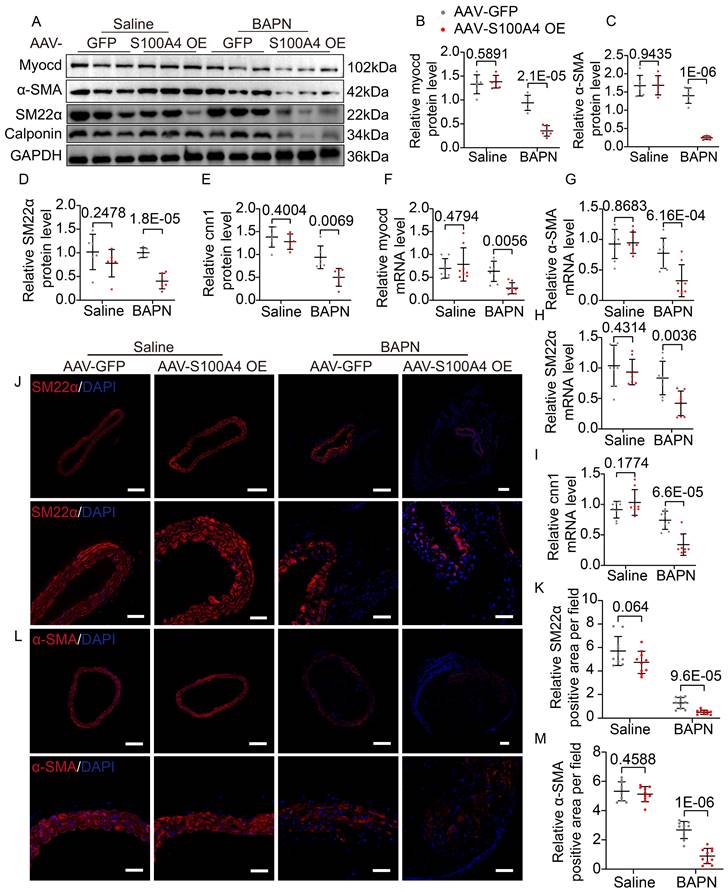 S100A4 Is a Key Facilitator of Thoracic Aortic Dissection