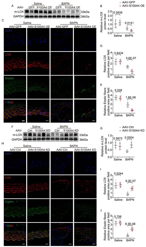 S100A4 Is a Key Facilitator of Thoracic Aortic Dissection