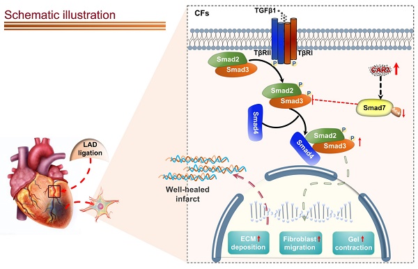 Carbonic Anhydrase 3 is required for cardiac repair post myocardial ...