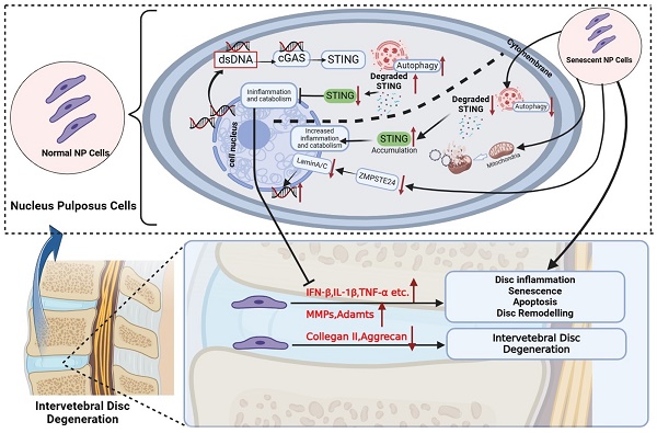 Dysfunction of STING Autophagy Degradation in Senescent Nucleus ...