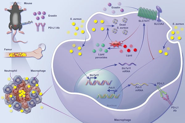 Aberrant Expression of SLC7A11 Impairs the Antimicrobial Activities of ...