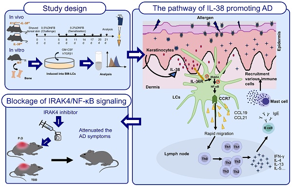IL-38 Aggravates Atopic Dermatitis via Facilitating Migration of ...